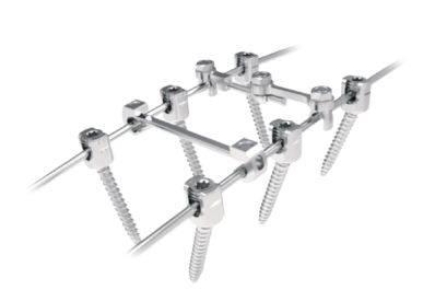 Silver Posterior Thoracolumbar Fixation System